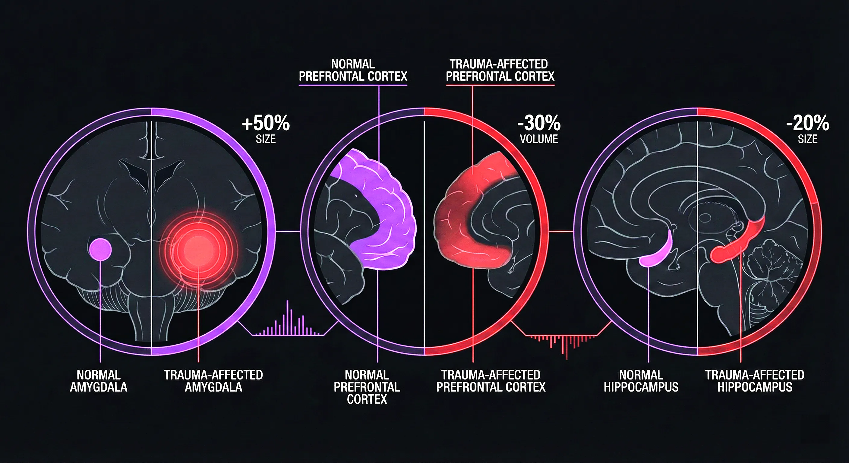 How Childhood Trauma Rewires Your Brain and What Science Says You Can ...